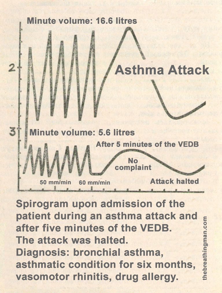 Buteyko Breathing Charts – The Breathing Man